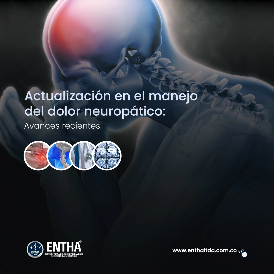 Actualización en el manejo del dolor neuropático: opciones terapéuticas ...